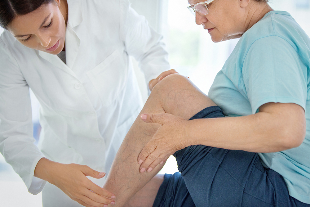 6 things you may not know about peripheral vascular disease - Flourish