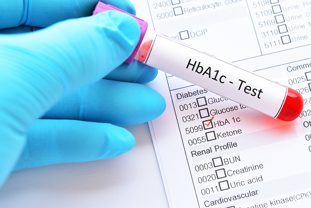Does a high A1c test mean you have diabetes? - Flourish